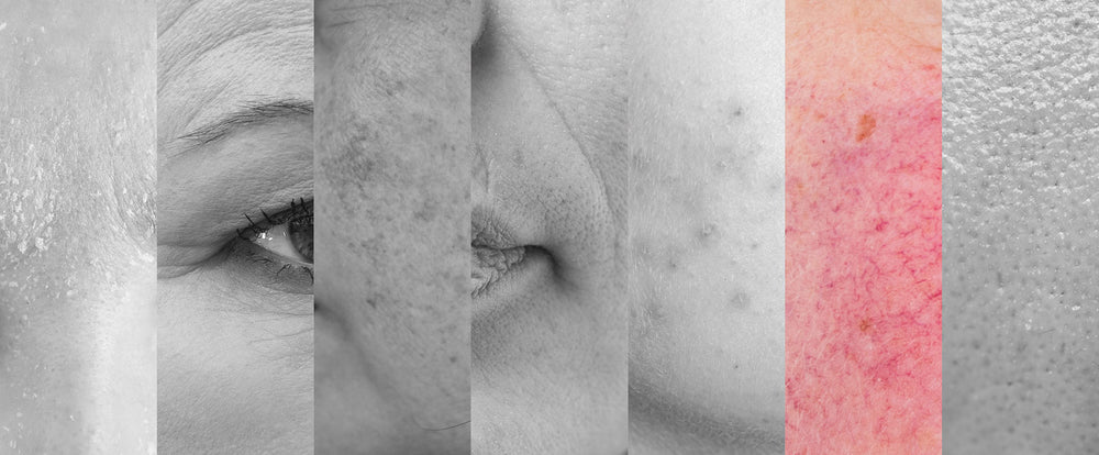 Redness and Sensitivity – skinfitnesstherapy
